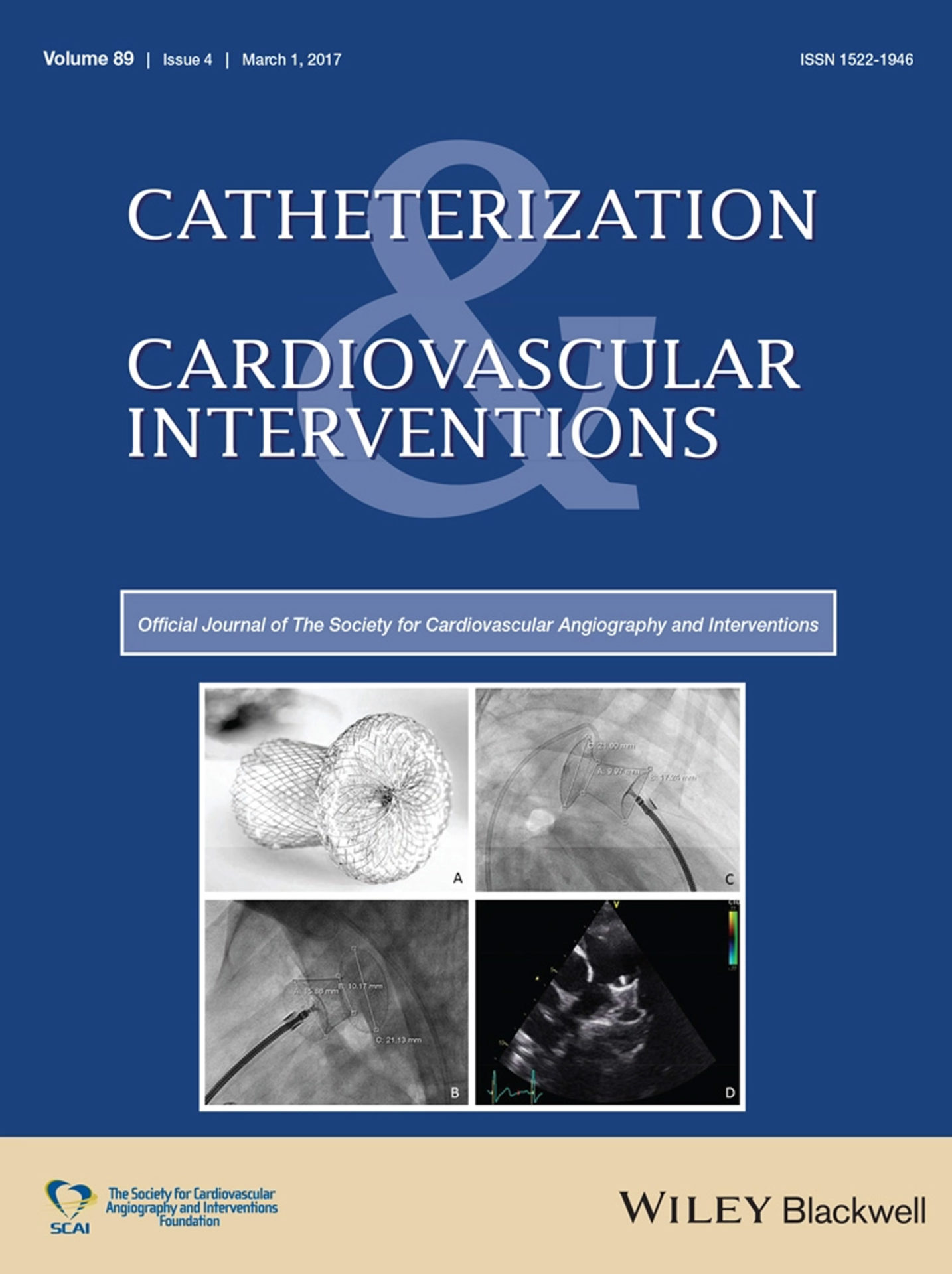 Discover the DWP technique : Direct Wire Pacing Technique